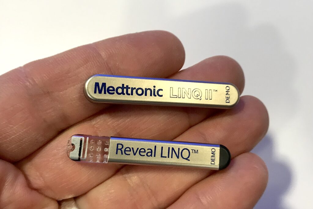 Ritmos cardiacos irregulares: posible detectarlos y tratarlos más ...